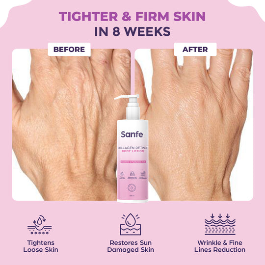 Body Lotion – Sanfe