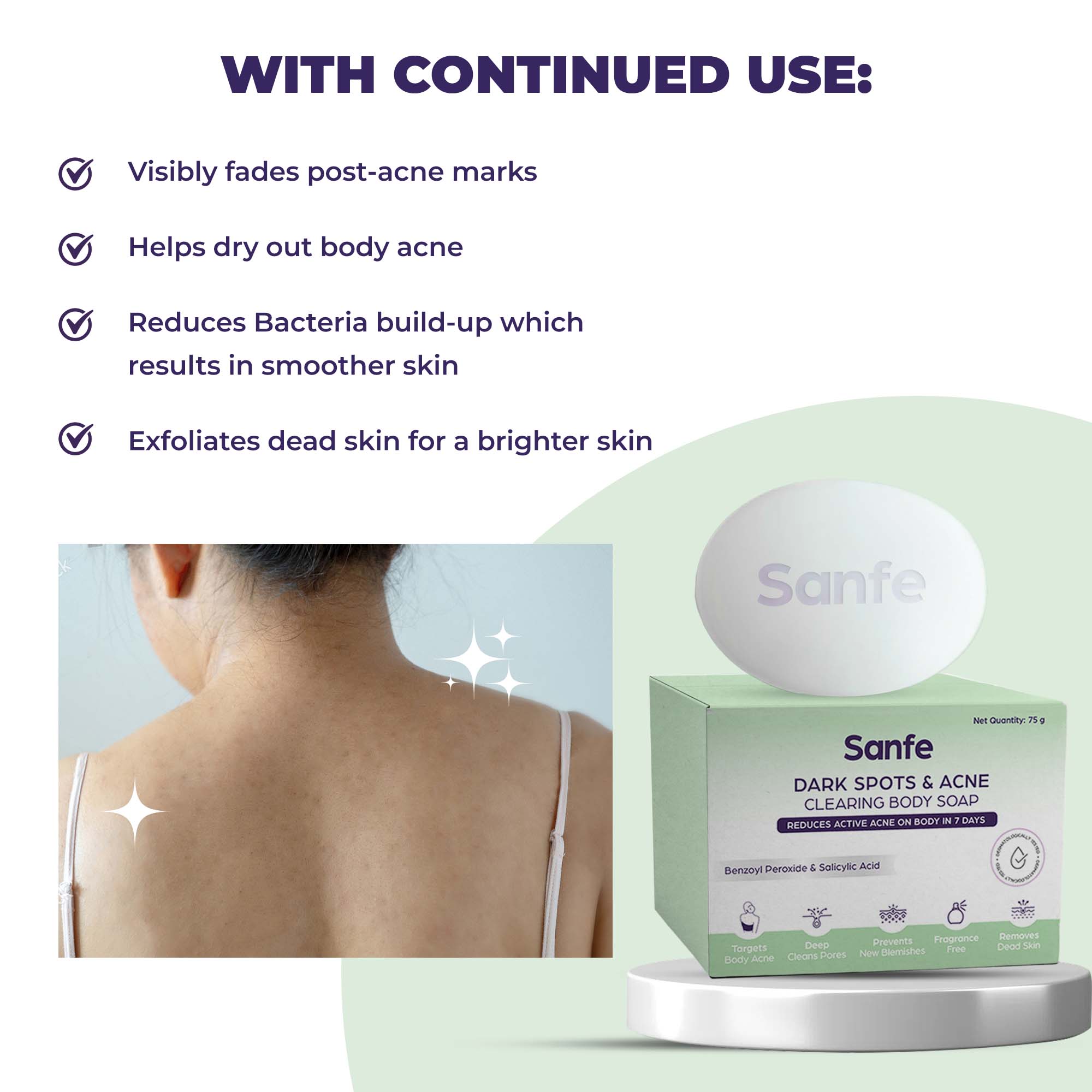 Dark Spots Acne Clearing Body Soap Pack of 3 Sanfe