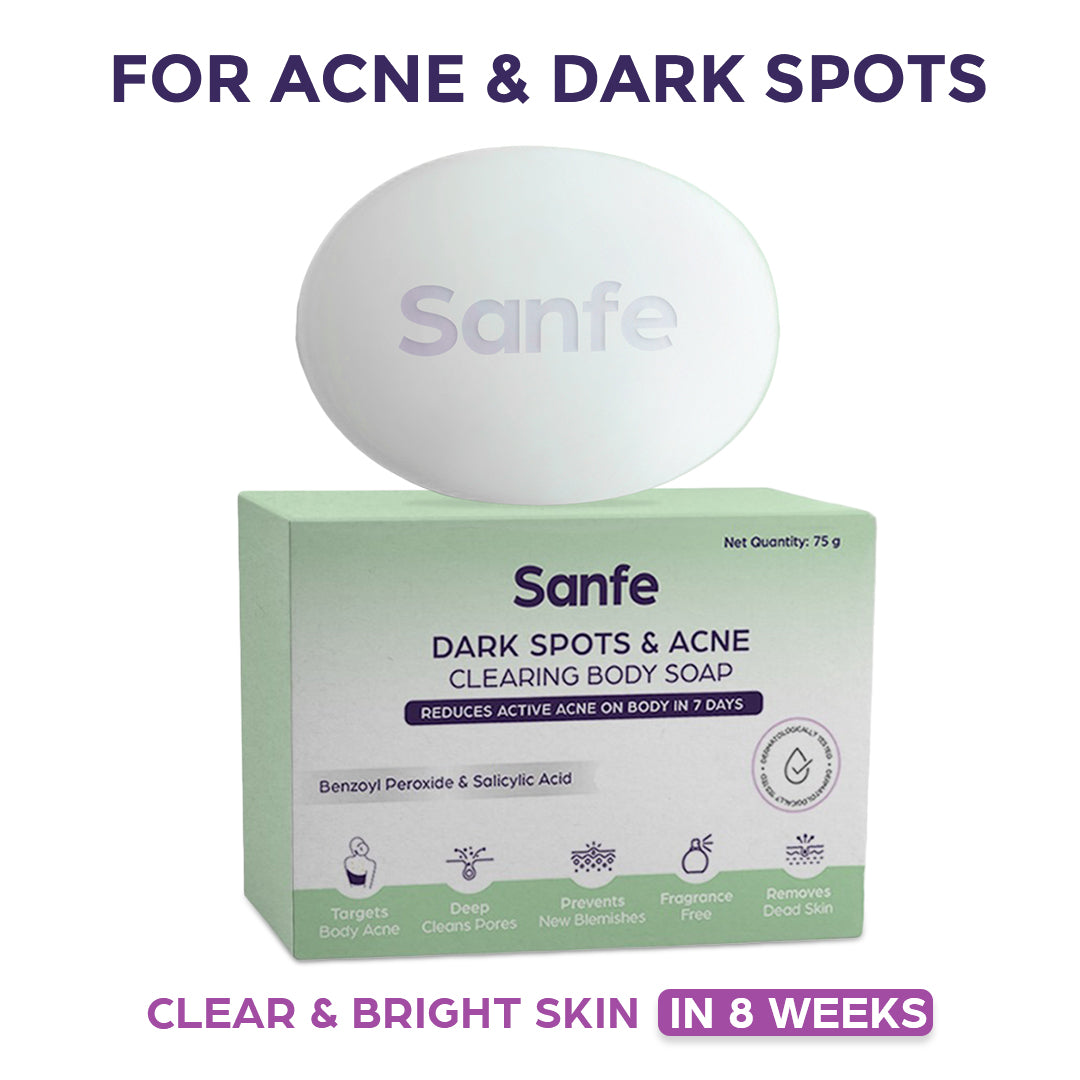 Acne Clearing Soap – Sanfe