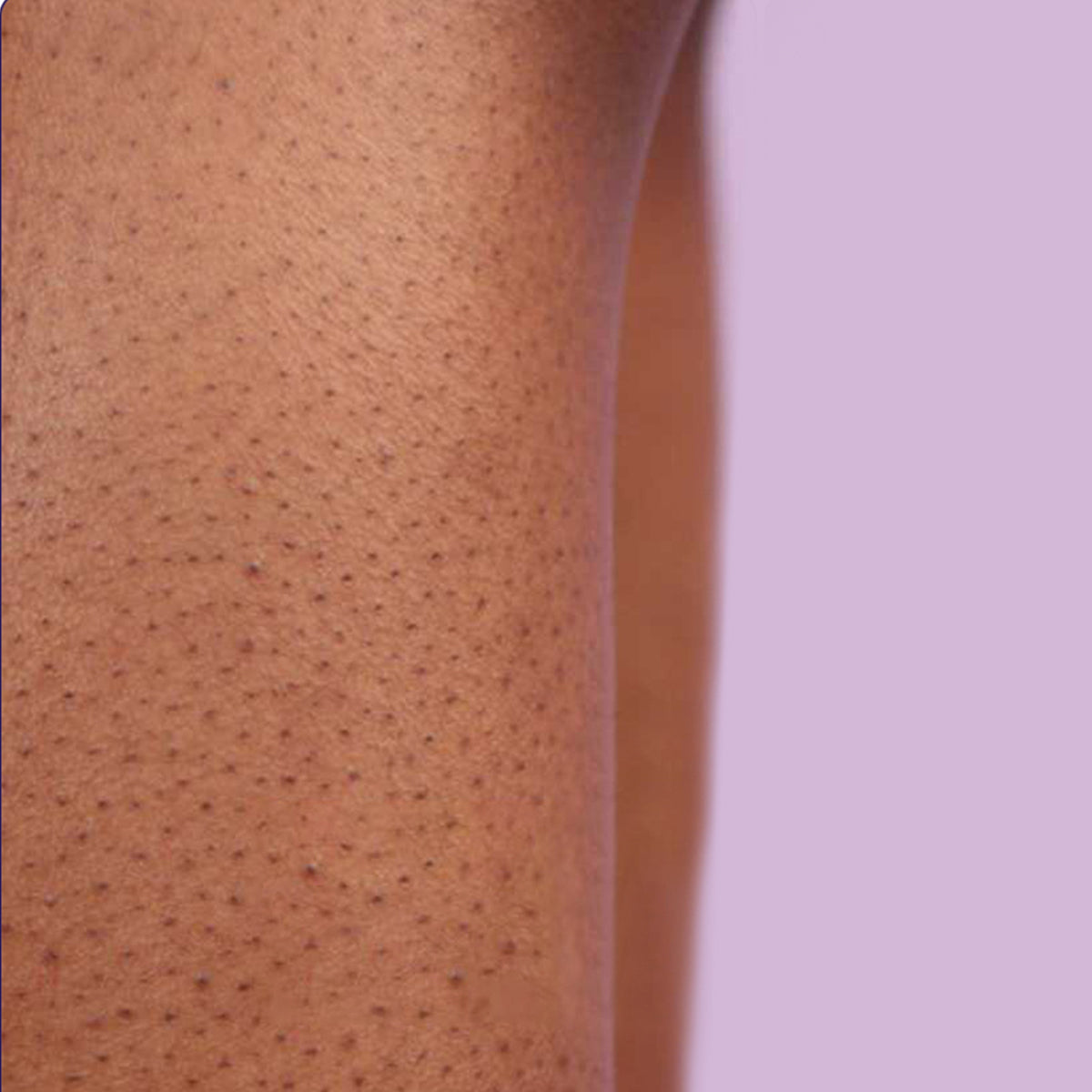 Bumps Erasing Body Scrub – Sanfe