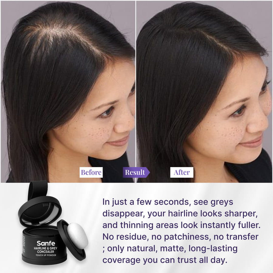 Sanfe Hairline & Gray Concealer Touch Up Powder | Instant Cover