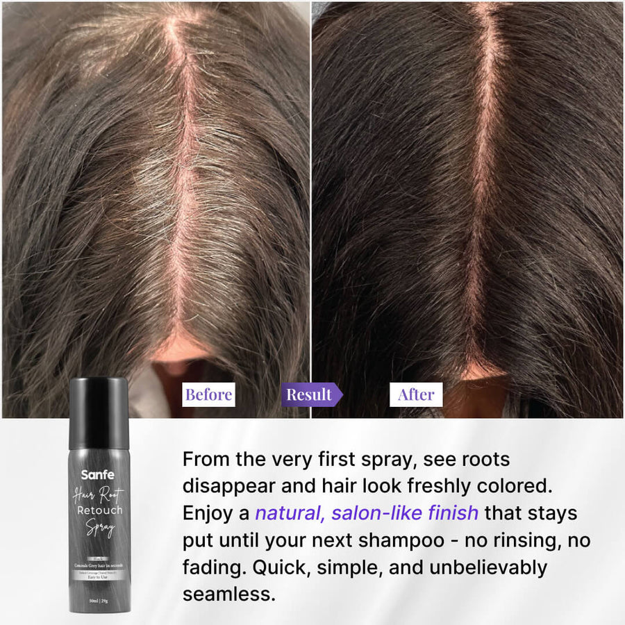 Sanfe Hair Root Retouch Spray | Instant Gray Coverage & Natural Finish